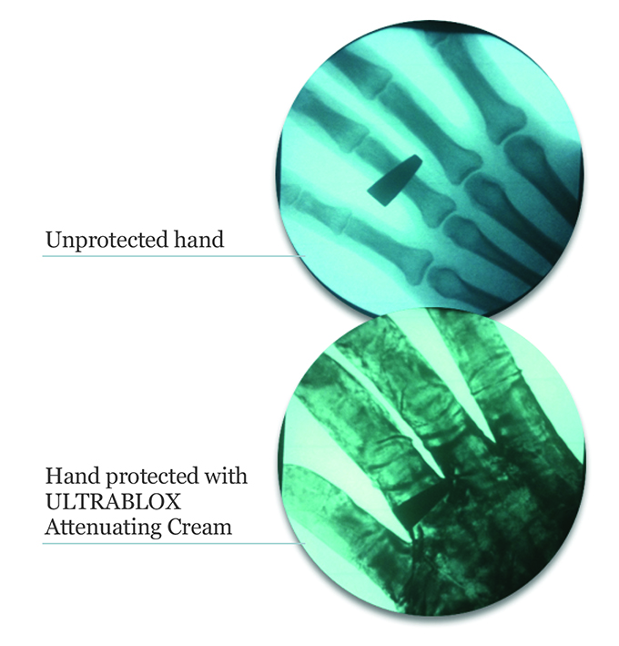 ULTRABLOX® X-Ray Attenuating Cream – BLOXR Solutions
